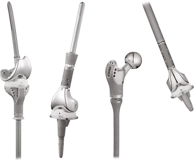USTAR II™ | Oncologie | United Orthopedic Corporation Suisse